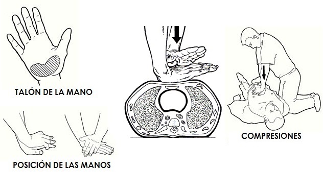 Masaje Cardíaco Externo - Primeros Auxilios y Socorrismo Acuático ...